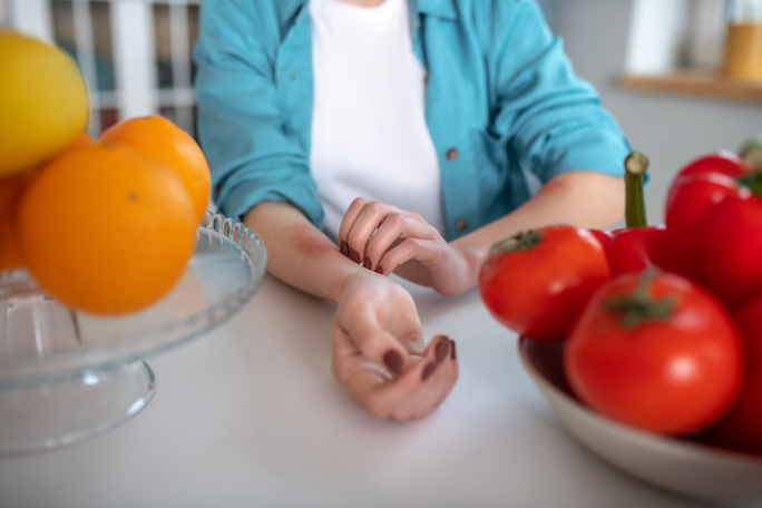 Learn the Three Main Types of Allergy Problems and How to Determine ...