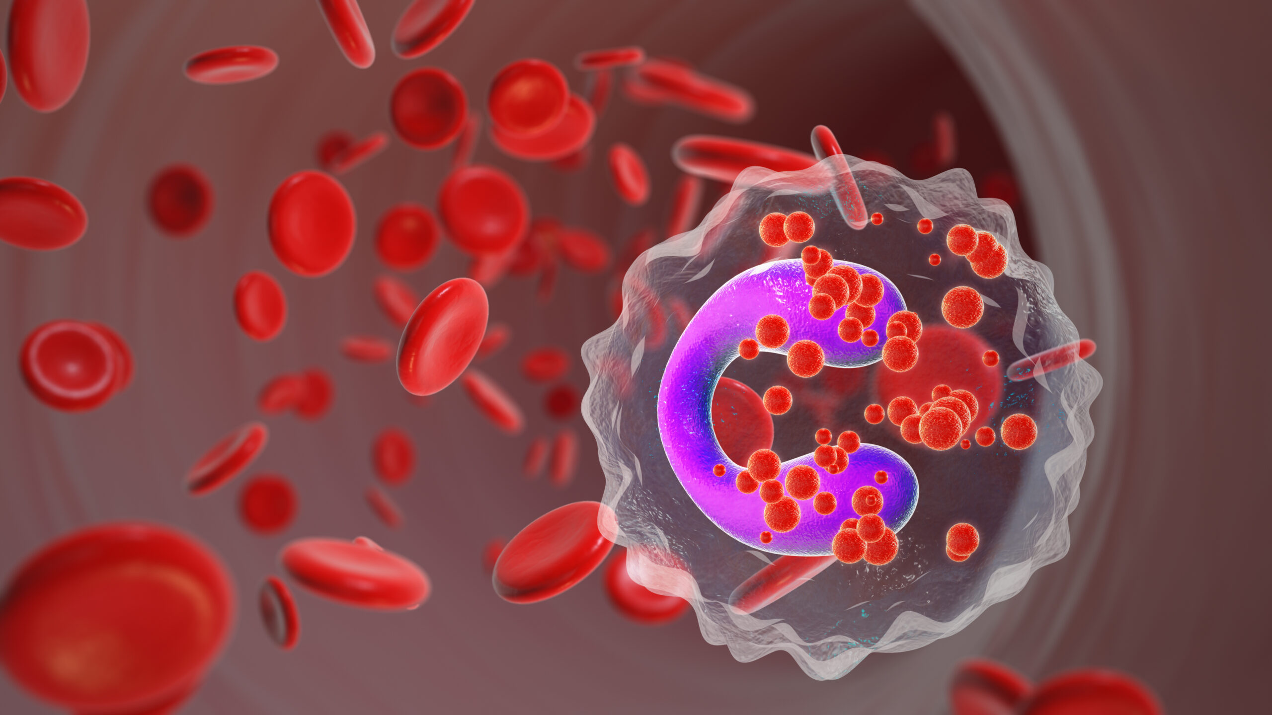 Eosinophilic Asthma Explained: Why Targeted Treatment Can Make a ...